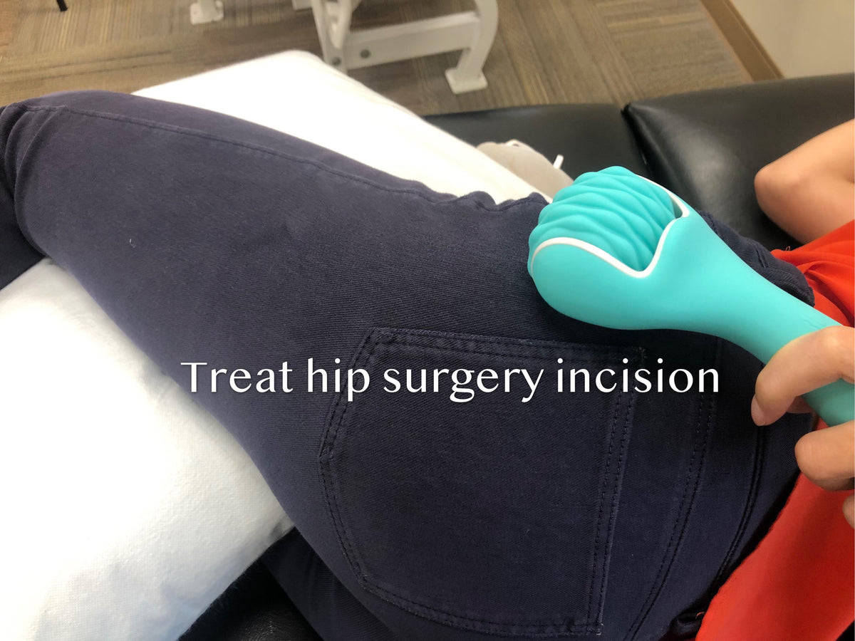 The Scar Roller - Wholesale